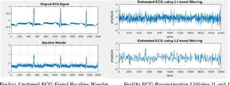 Table 1 From An Ecg Signal Denoising Method Using Filtering Techniques Semantic Scholar
