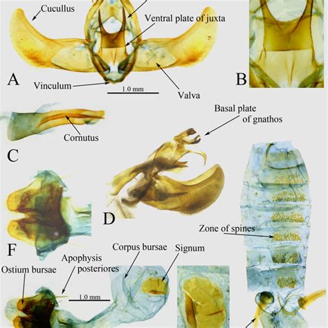 Male And Female Genitalia And Abdomen Of Ptilothyris Purpurea Download Scientific Diagram