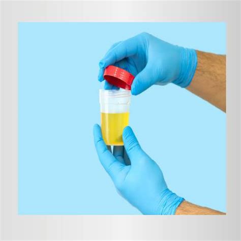 24 Hour Urine Collection Loyal Hearts