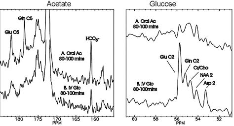 Figure 1 From Applications Of Hyperpolarized Metabolism Hyperpolarized