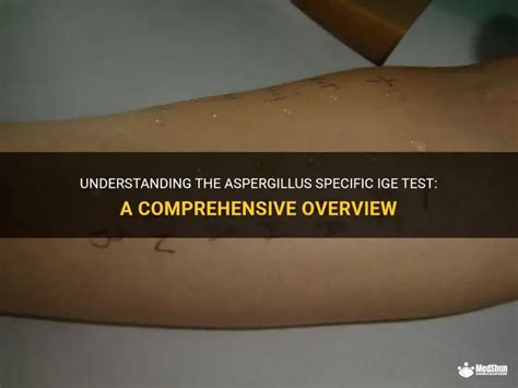 Understanding The Aspergillus Specific Ige Test A Comprehensive Overview Medshun