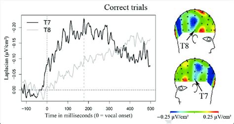 Eeg Activity After Surface Laplacian Transformation Recorded Over T7