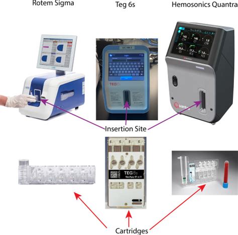 The Role Of Viscoelastic Hemostatic Assays For Postpartum Hemorrhage