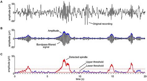 sleep spindle eeg frequency