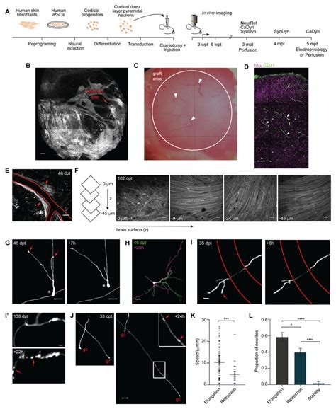 Single Cell Resolution In Vivo Imaging Of Human Cortical Tissue Grafts