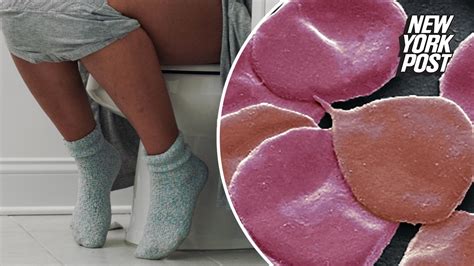 6 Common Symptoms Of Colon Cancer In Young People Au