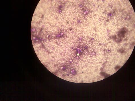 Cryptococcus Neoformans Medik Bloglist