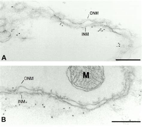 Actin Is A Constituent Of The Nucleoplasmic Npc Associated Filaments As