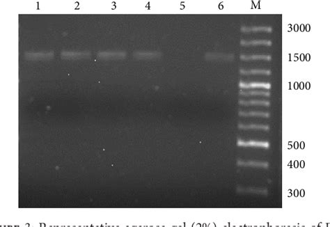 Figure 3 From Prevalence Of Protozoa Species In Drinking And Environmental Water Sources In