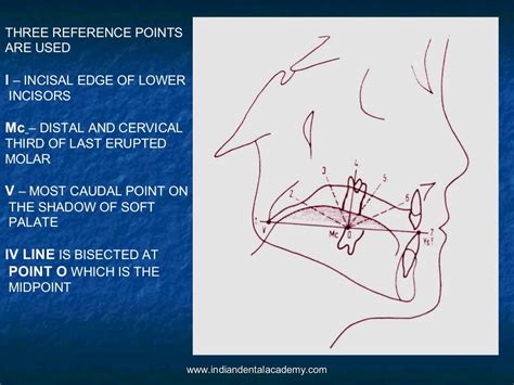 Soft Tissue Cephalometric Analysis Certified Fixed Orthodontic Cours