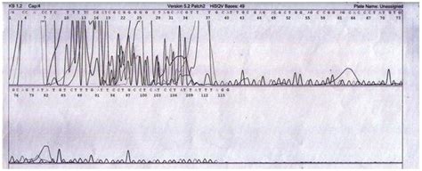 Electropherogram Sequencing Results Download Scientific Diagram