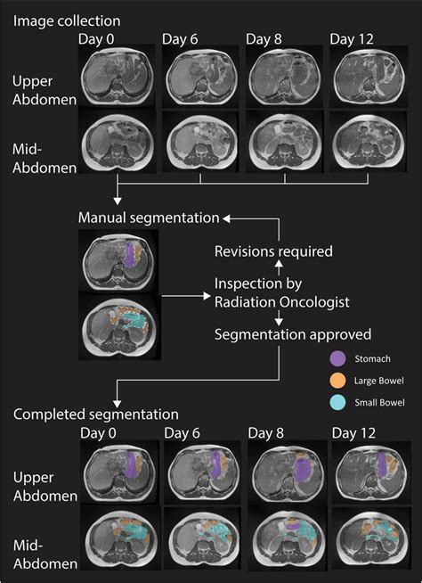 Schema Representation Of Image Collection And Manual Segmentation Of Download Scientific