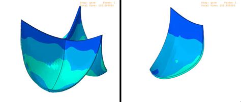 4realsim On Linkedin Abaqus Finiteelementanalysis Valvereplacement