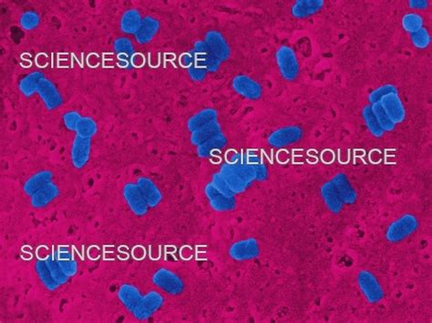 rhabdovirus scanning electron microgr stock image science source images