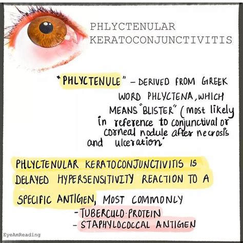 Best Eye Clinic In Lahore On Linkedin Phlyctenular Conjunctivitis