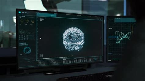 Brain Scan Analyzed In Advanced Medical Software At Neurosurgery Laboratory Motion Graphics