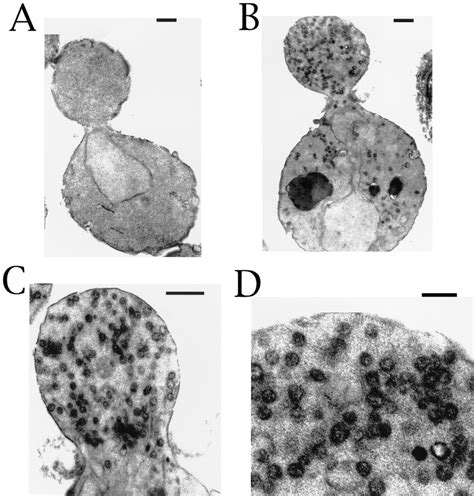 bee1 cells accumulate vesicles in the bud. Thin-sectioning electron ...