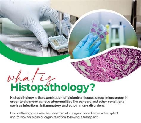 What Is Histopathology — An Overview By I3tk Medium