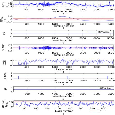 Figure From Noise Aware Dictionary Learning Based Sparse Representation Framework For