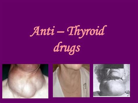 Thyroid Hormones And Anti Thyroid Drugsppt