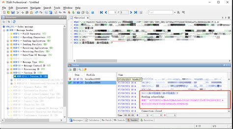 7edit解析工具的使用 二 csdn博客