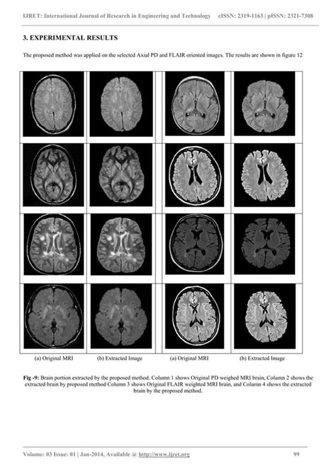 A Novel Approach For Efficient Skull Stripping Using Pdf