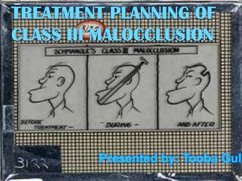Class Iii Malocclusion Pptx