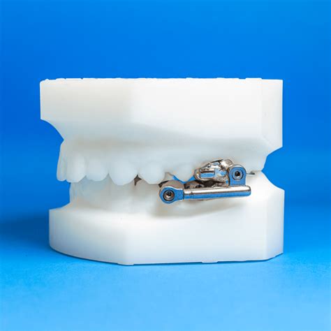 Hanks Telescoping Herbst Specialty Appliances