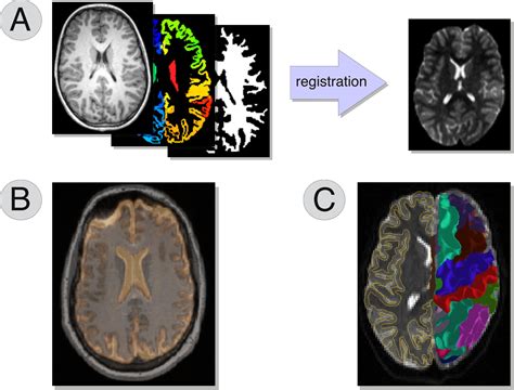 New Paper In Diffusion MRI By Alessandro Daducci Et Al EPFL