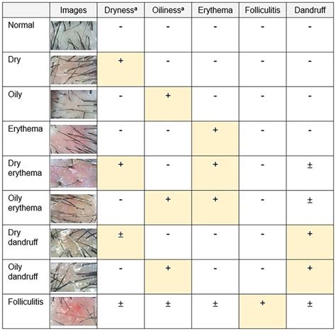 Classification Of Scalp Types Scalp Photographic Index Artificial Download Scientific Diagram