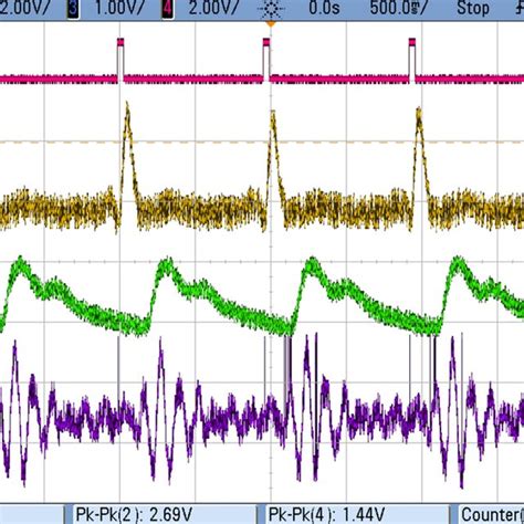 3d Evolution Of 10 Period Of Ecg With Minor Baseline Wander Download Scientific Diagram
