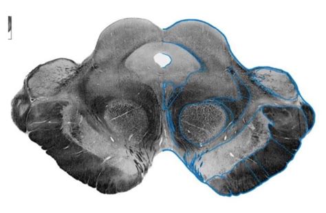 Midbrain Diagram Diagram Quizlet