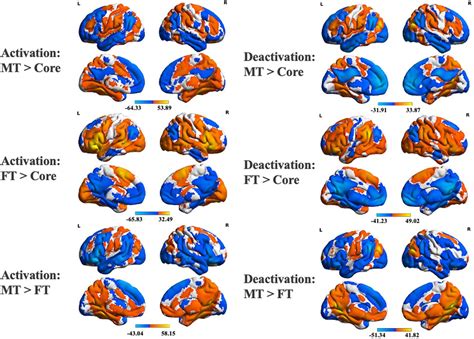 Distinctive And Complementary Roles Of Default Mode Network Subsystems In Semantic Cognition