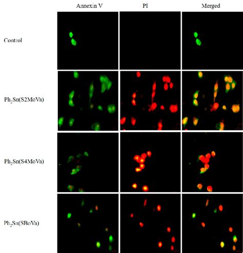 Apoptosis Detection Through Fluorescence Microscopy Cells Were Treated Download Scientific