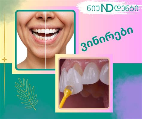 ნიუ დენტი New Dent