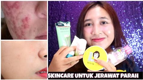 Inilah Skincare Terampuh Untuk Menghilangkan Jerawat Yang Parah - Seminggu Hasilnya Kelihatan ...