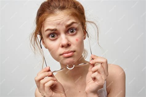 Premium Photo Woman Face With Pimple Skin Problems Closeup High Quality Photo