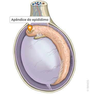 Apêndice Do Epidídimo E Anatomy Imaios