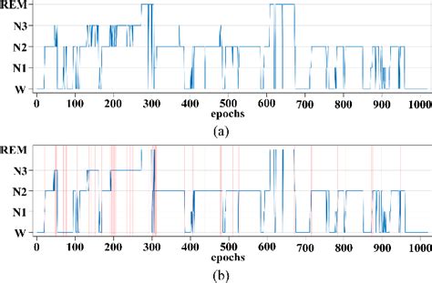 Figure 6 From A Feature Fusion Model Based On Temporal Convolutional Network For Automatic Sleep