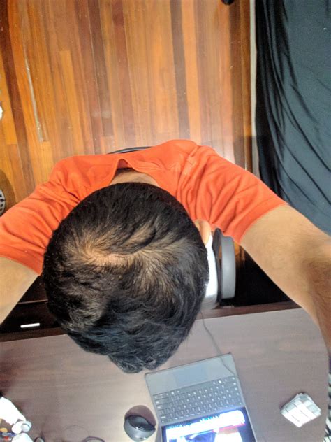 Hair Mod Does Anyone Know Where These Mods Are From Rffxiv