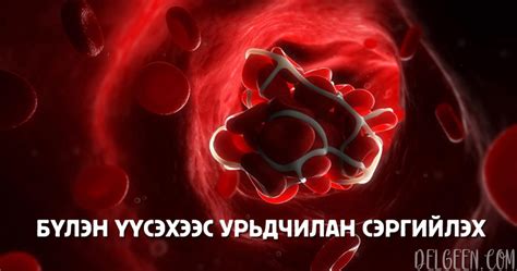 Эрүүл мэндэд ноцтой аюултай цусны бүлэн үүсэхээс хэрхэн сэргийлэх вэ Цус шингэлэх хамгийн үр