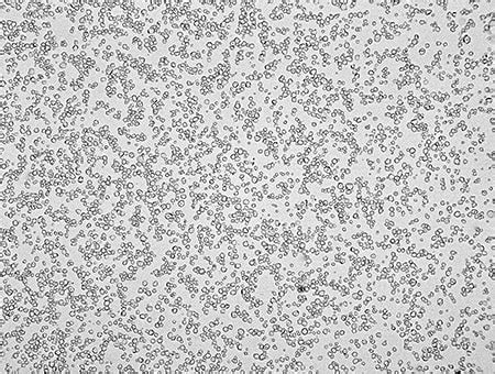 Particle Size Distribution And Particle Size Analysis Using Image Processing Other Industries