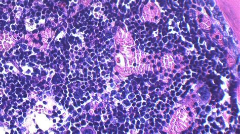 Antibody Transforms Bone Marrow Stem Cells Directly Into Brain Cells