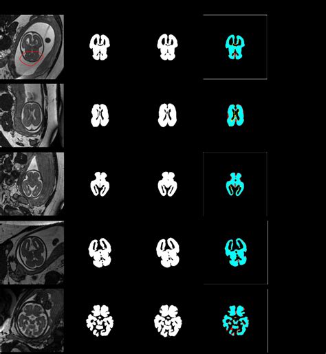 Segmentation Results For Middle Slices In The Fourth Row The Ground Download Scientific