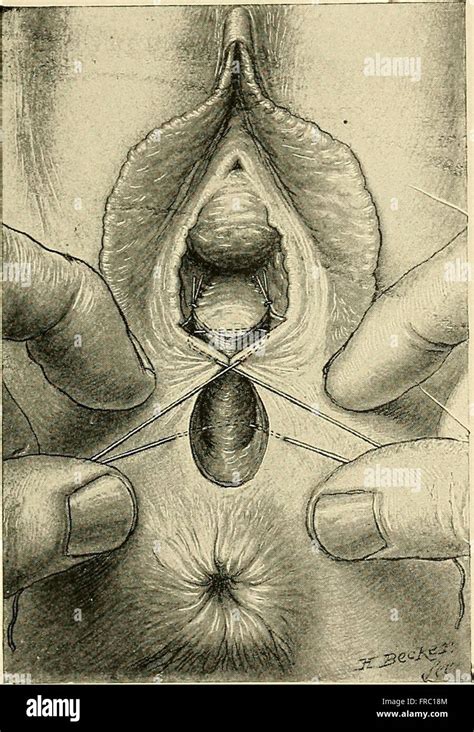 This Text Provides An In Depth Exploration Of The Diagnosis And Treatment Of Various