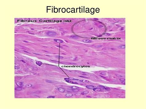 Fibrocartilage 40x