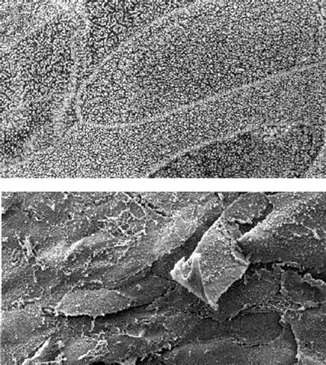 Coca Cola Douches And Contraception The BMJ