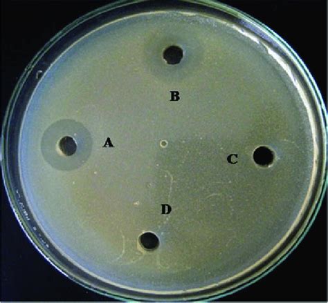Antimicrobial Activity Of Protein During Purification Steps A Activity