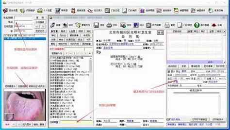 1、界面全屏化，根据屏幕分瓣率自动调整界面大小；