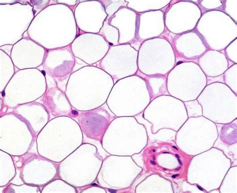 Adipose Tissue Flashcards Quizlet
